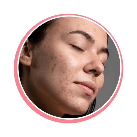 Skincare Essential Kits for Complete Care | Pure Skin Studio – Pure ...